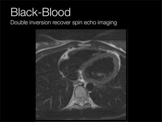 Cardiac mr sequences | PDF