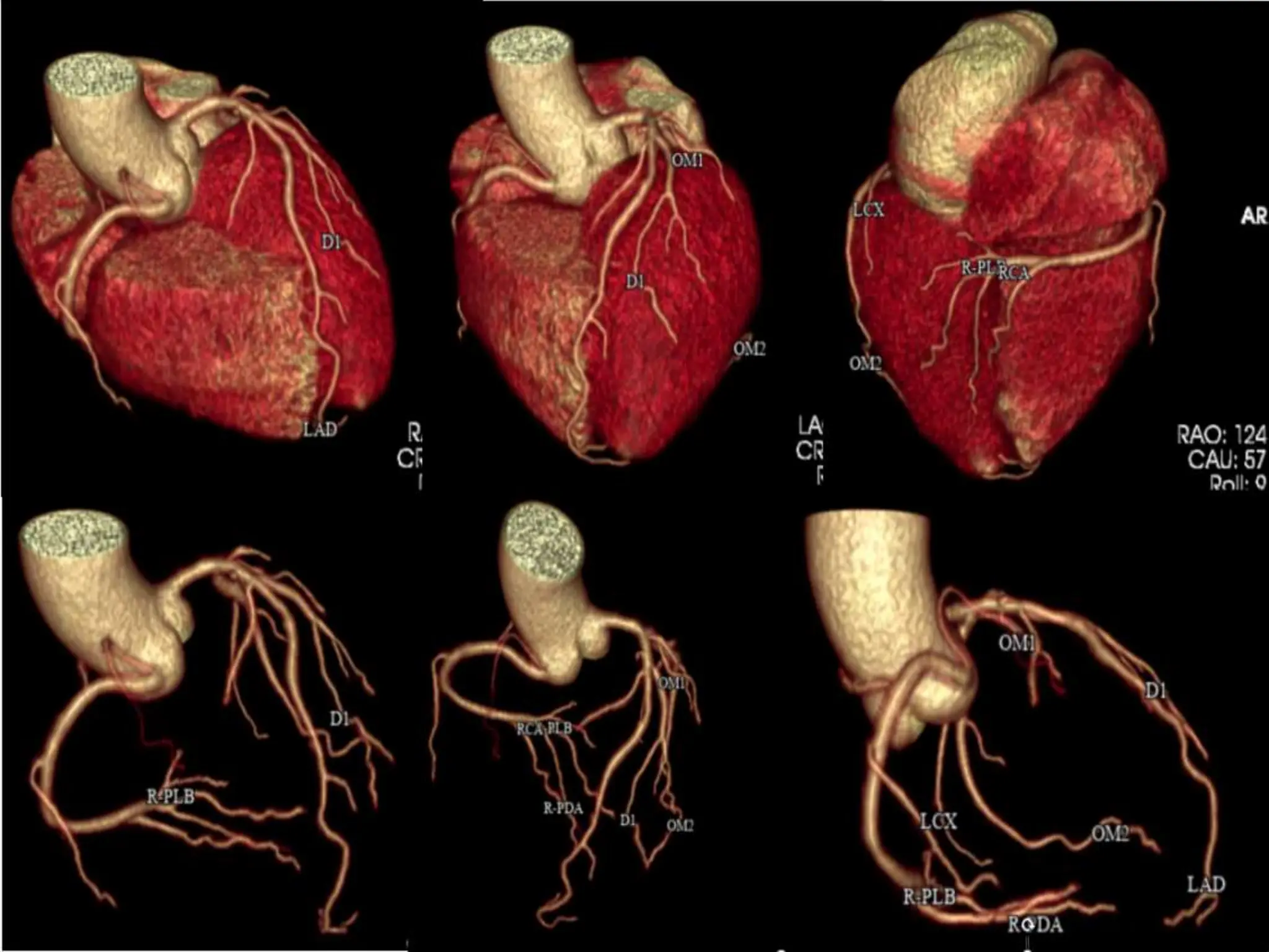 cardiac multislice CT.prospective ECG ,retrospective ECG Gating.pptx