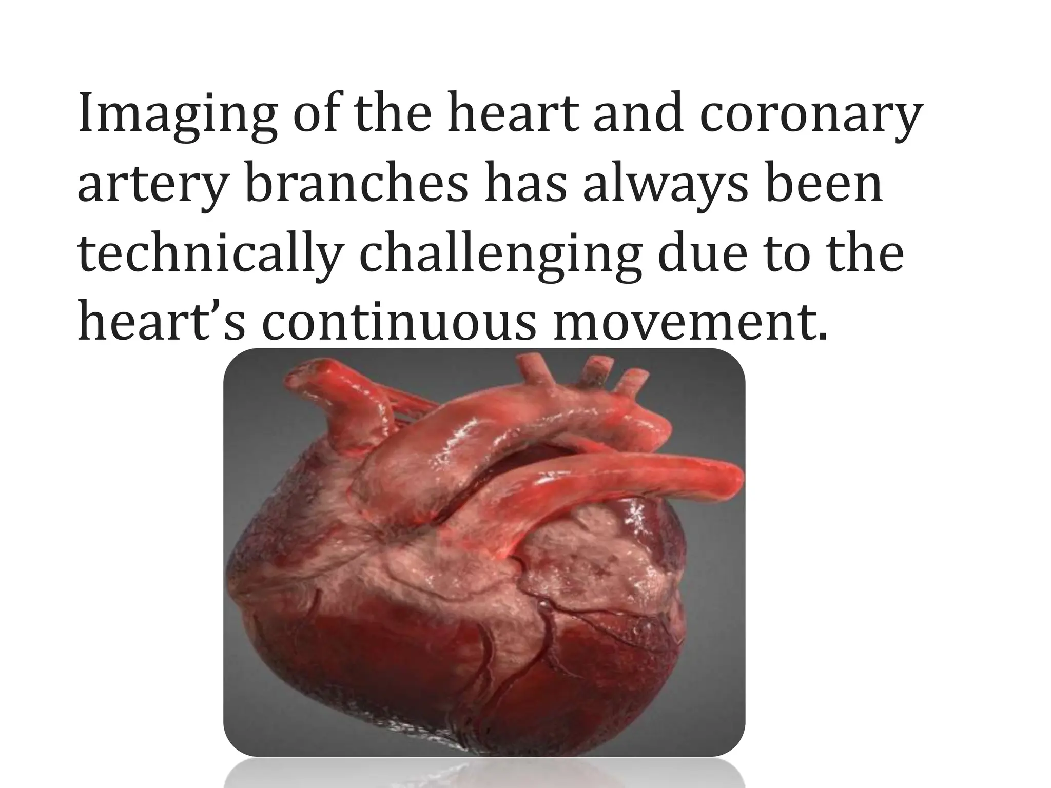 cardiac multislice CT.prospective ECG ,retrospective ECG Gating.pptx