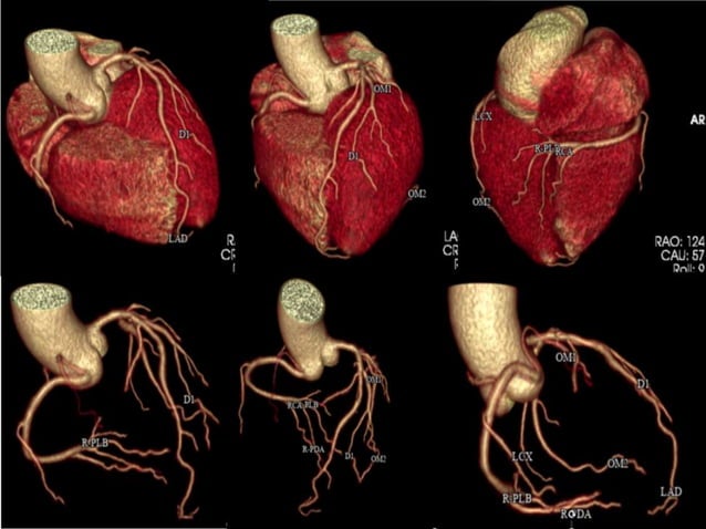 cardiac multislice CT.prospective ECG ,retrospective ECG Gating.pptx