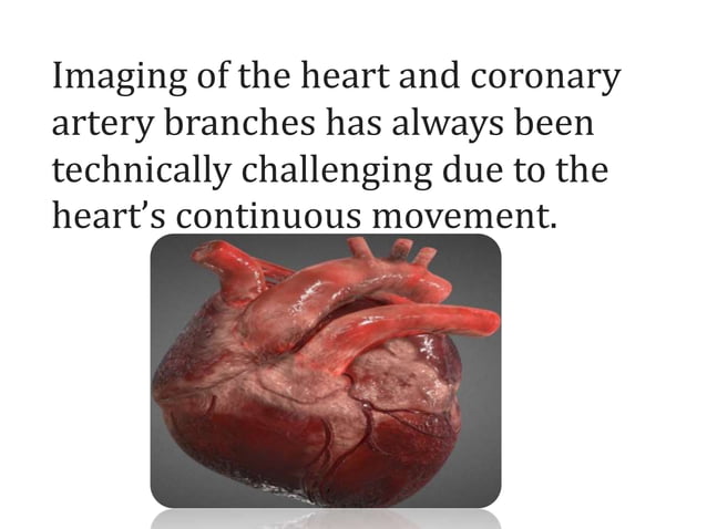 cardiac multislice CT.prospective ECG ,retrospective ECG Gating.pptx