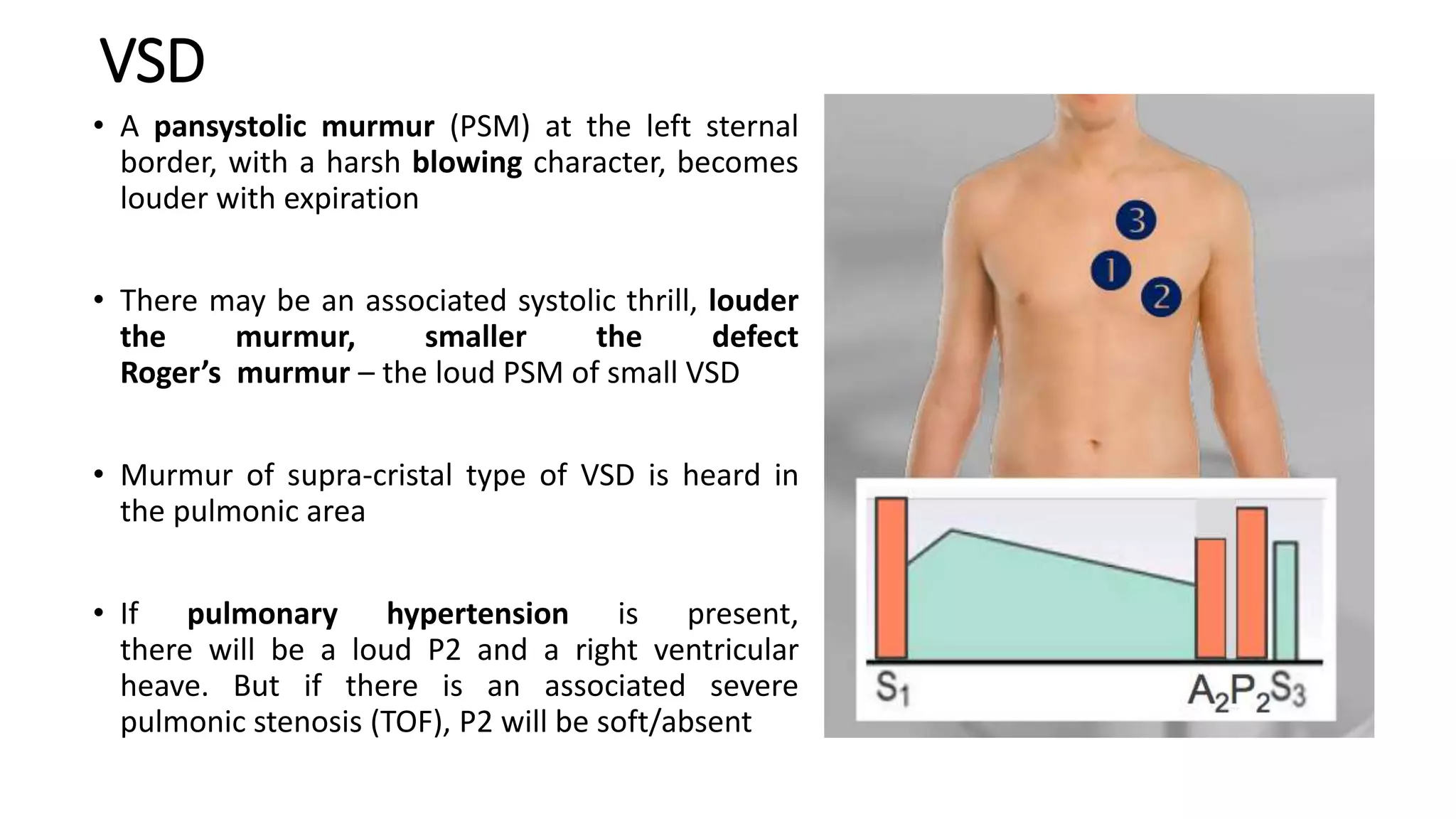 Cardiac Murmur & Dynamic Auscultation.pptx