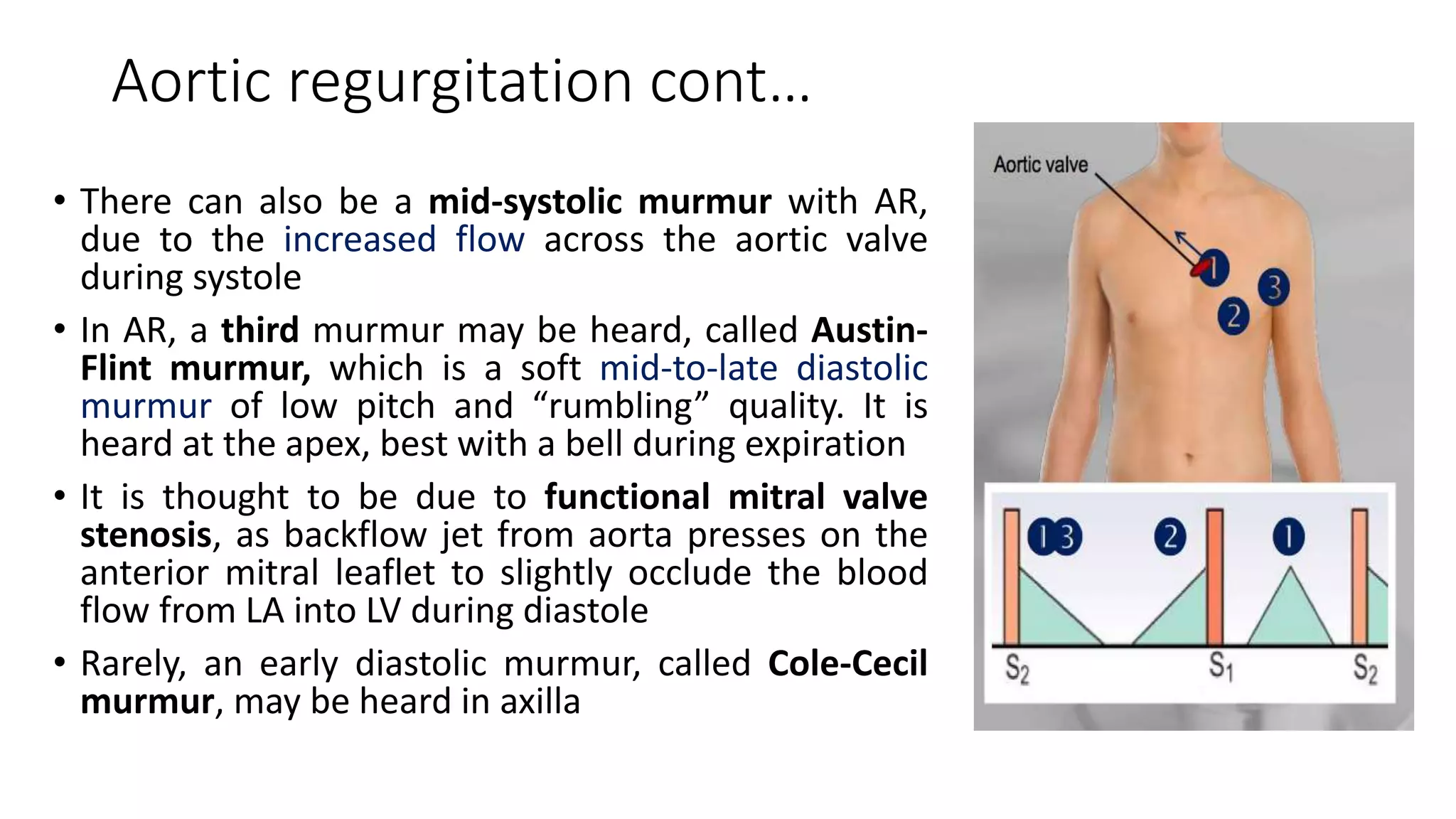 Cardiac Murmur & Dynamic Auscultation.pptx