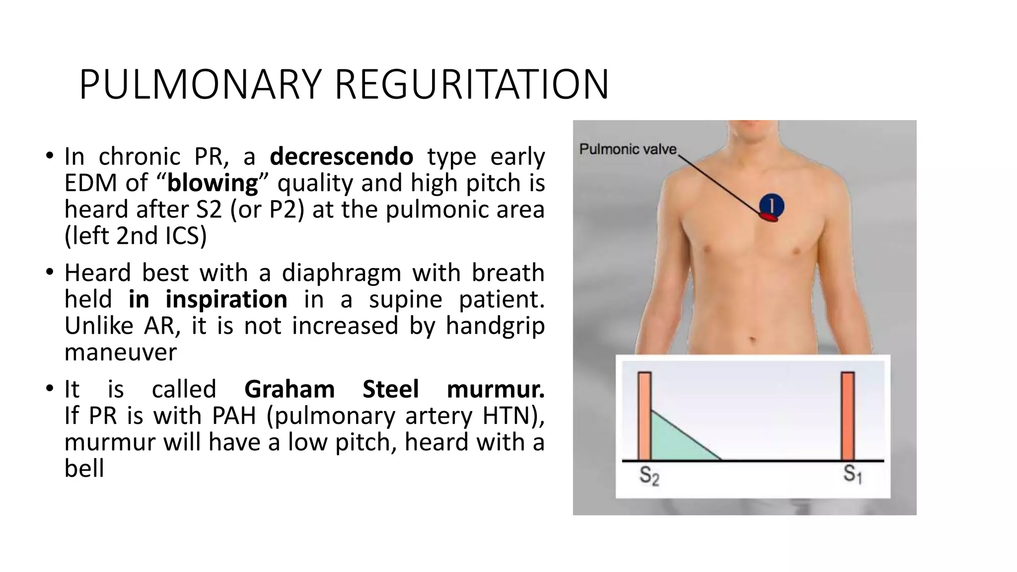 Cardiac Murmur & Dynamic Auscultation.pptx