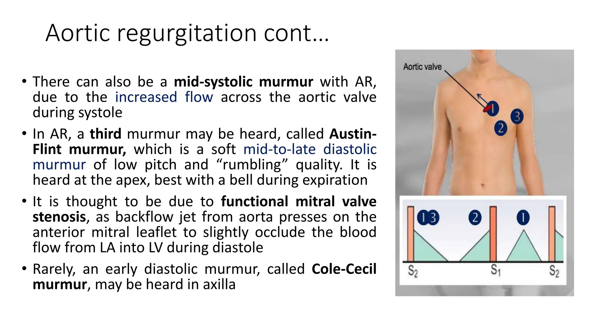 Cardiac Murmur & Dynamic Auscultation.pptx