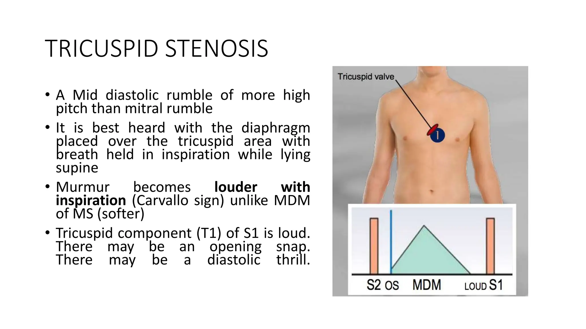 Cardiac Murmur & Dynamic Auscultation.pptx