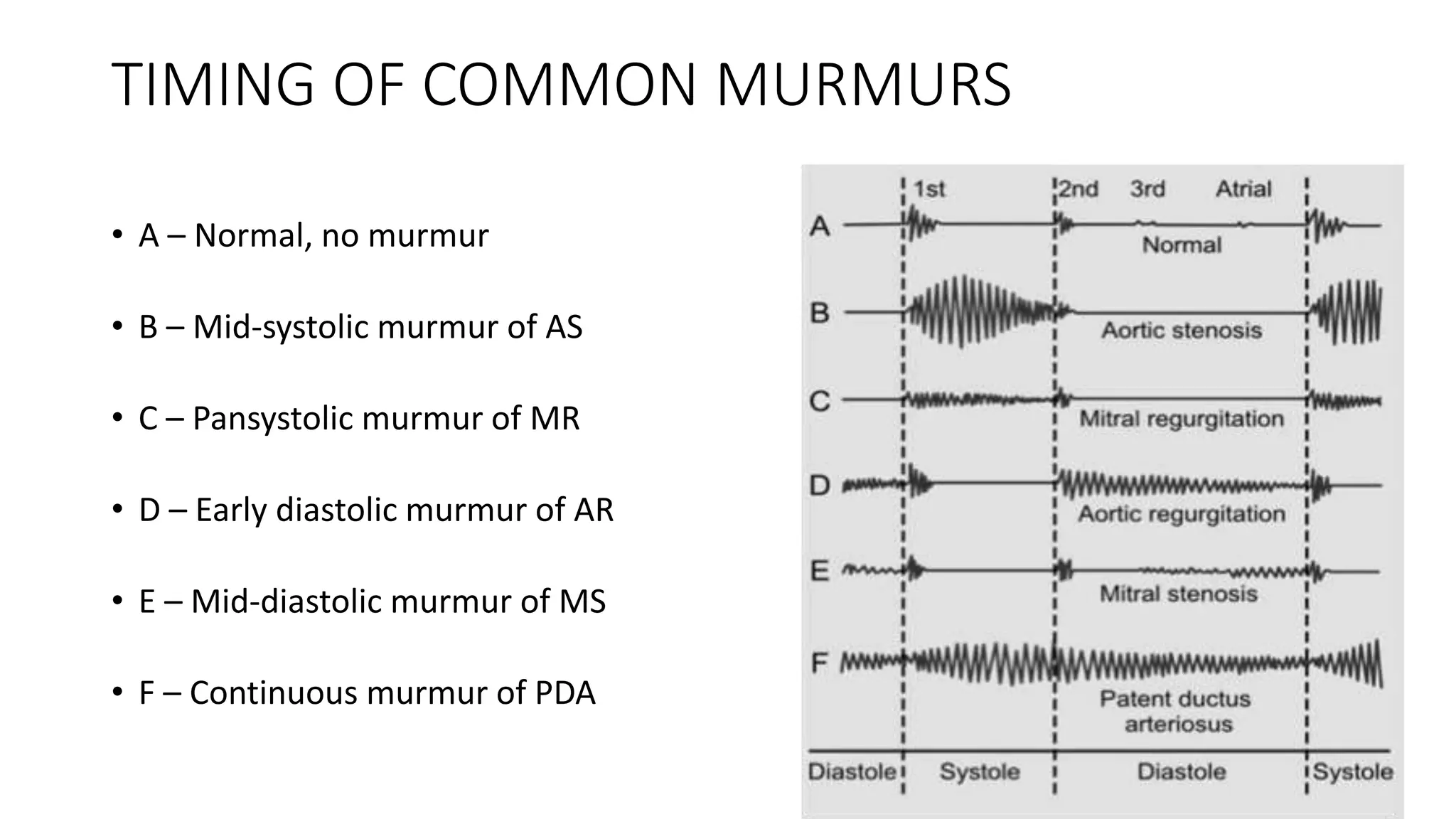 Cardiac Murmur & Dynamic Auscultation.pptx