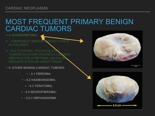 Cardiac neoplasms | PPTX