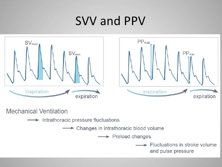 Haemodynamic monitoring