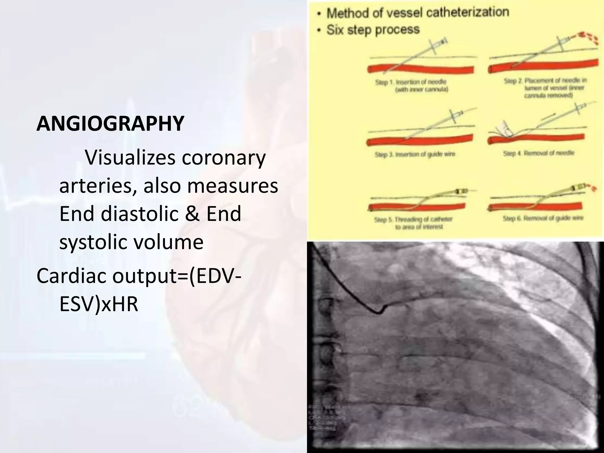 MEASUREMENT OF CARDIAC OUTPUT | PPTX