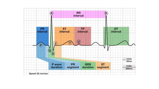 Cardiac output and ECG for sem 8 bpharm s | PPTX | Heart and ...