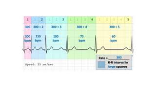 Cardiac output and ECG for sem 8 bpharm s | PPTX | Heart and ...