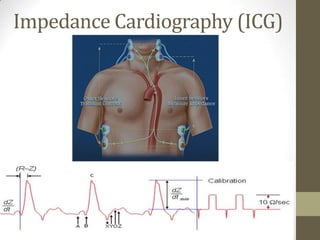 Cardiac output 2 | PPTX