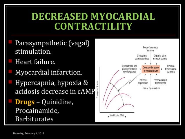 Cardiac output 2