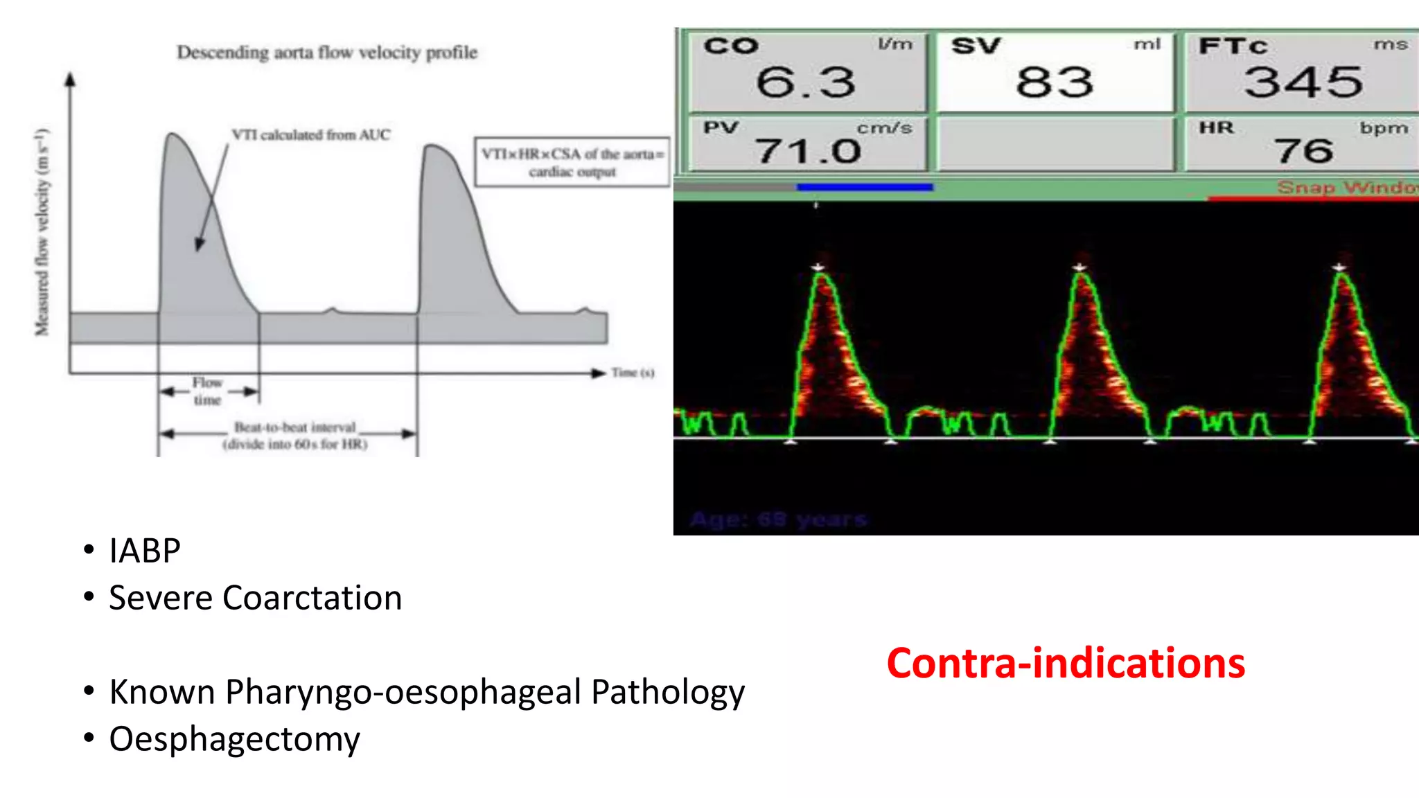 cardiac output pptx | PPTX