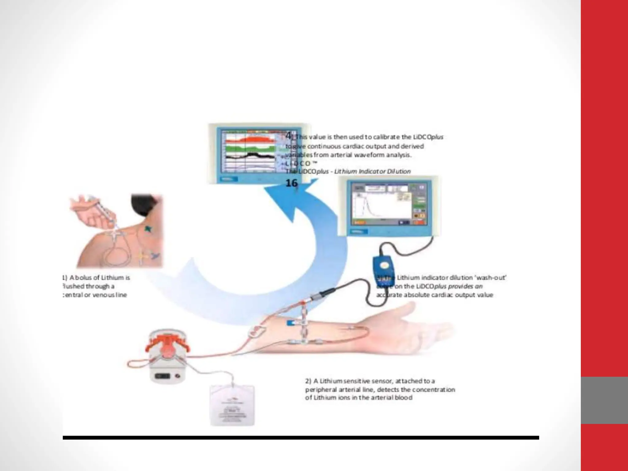 cardiac output measurment and monitoring ppt-1.pptx