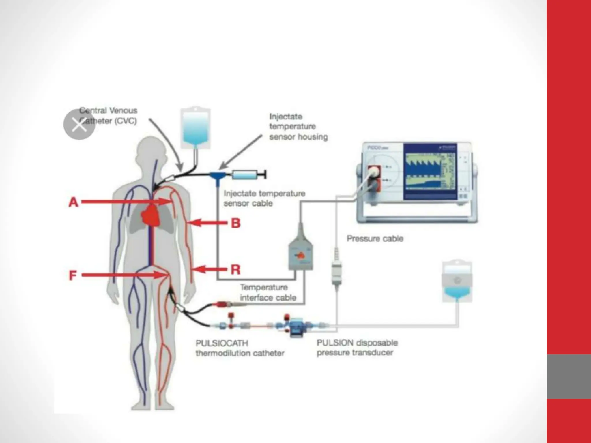 Cardiac Output Measurment And Monitoring Ppt 1 Pptx