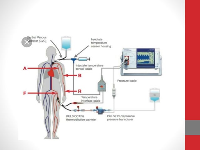 cardiac output measurment and monitoring ppt-1.pptx