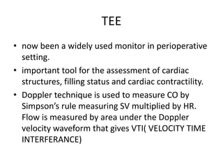 Cardiac output monitoring | PPTX