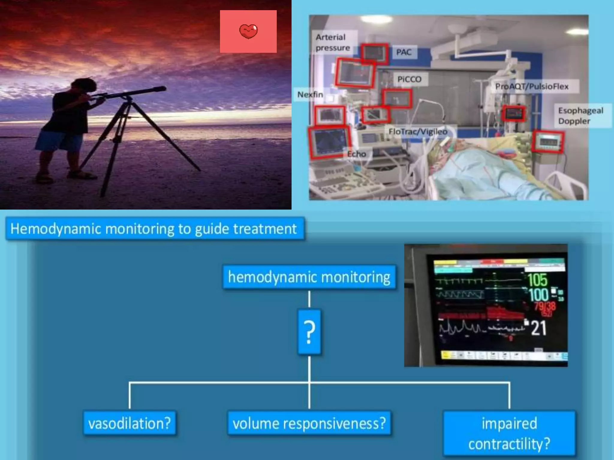 Cardiac output & monitoring | PPT