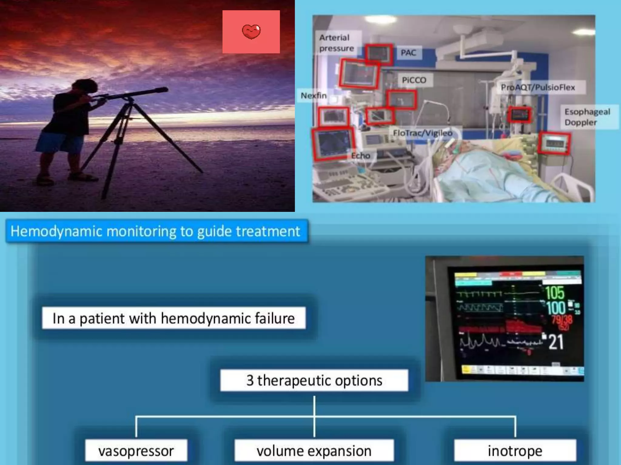 Cardiac output & monitoring | PPT