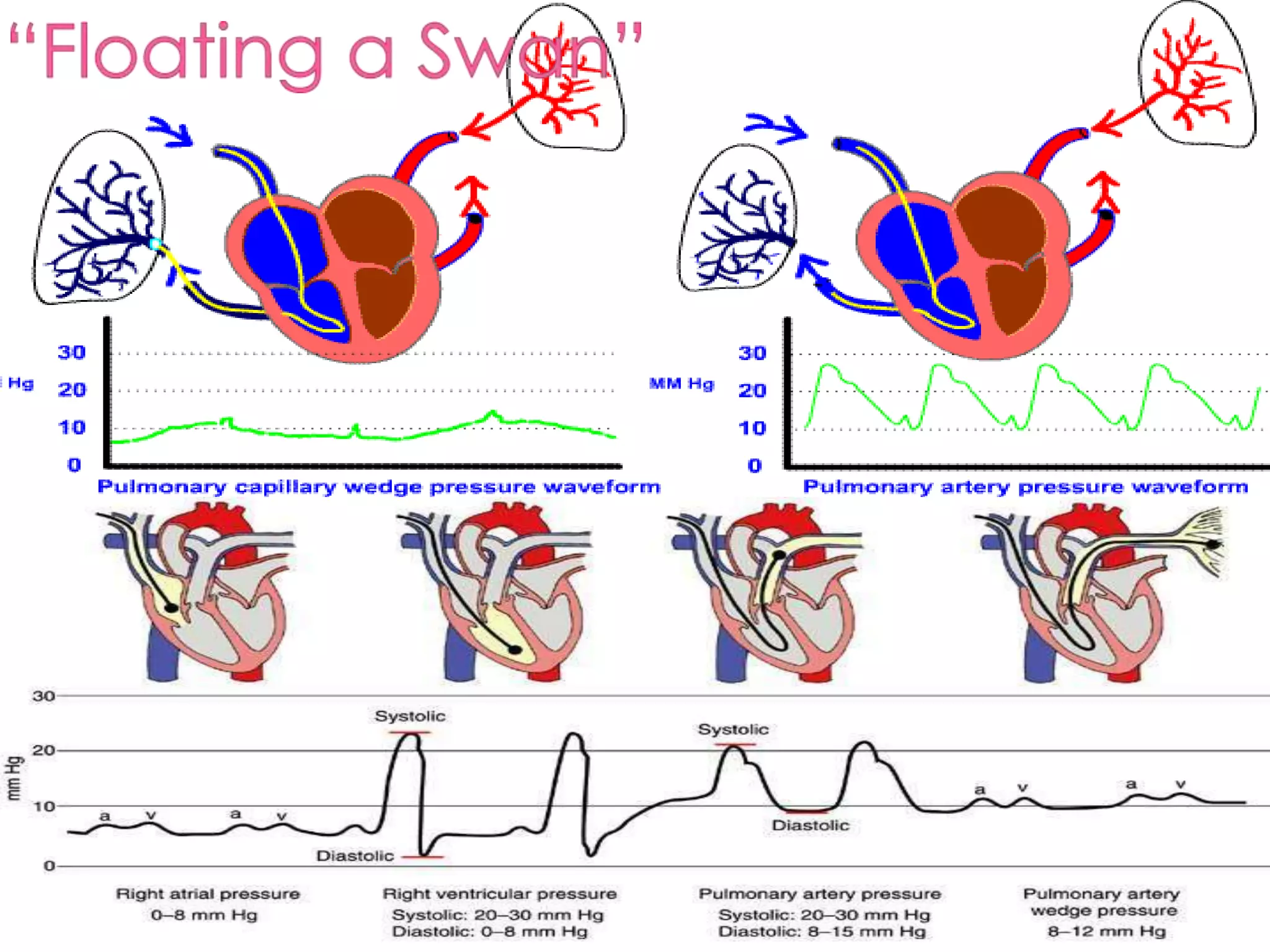 Cardiac output & monitoring | PPT