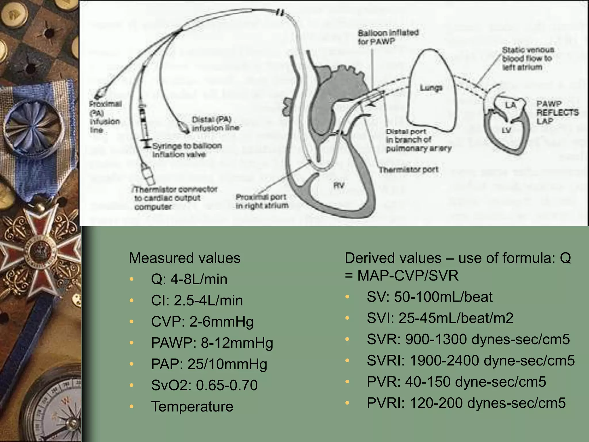 Cardiac output & monitoring | PPT