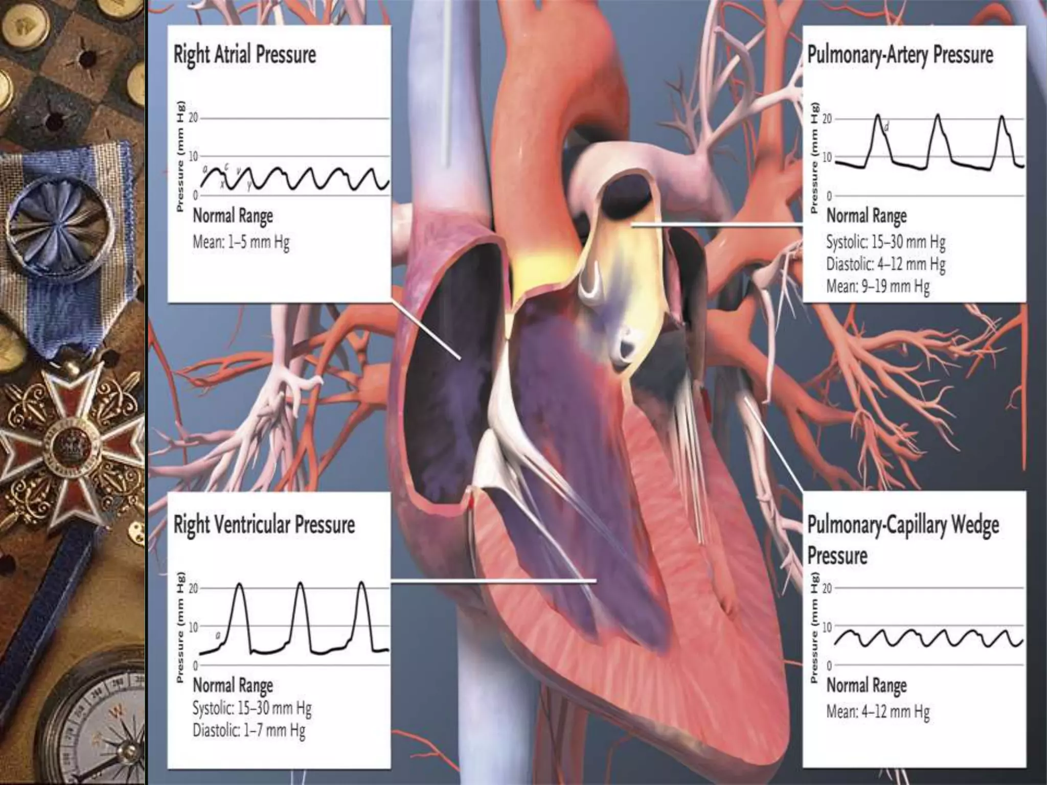 Cardiac output & monitoring | PPT