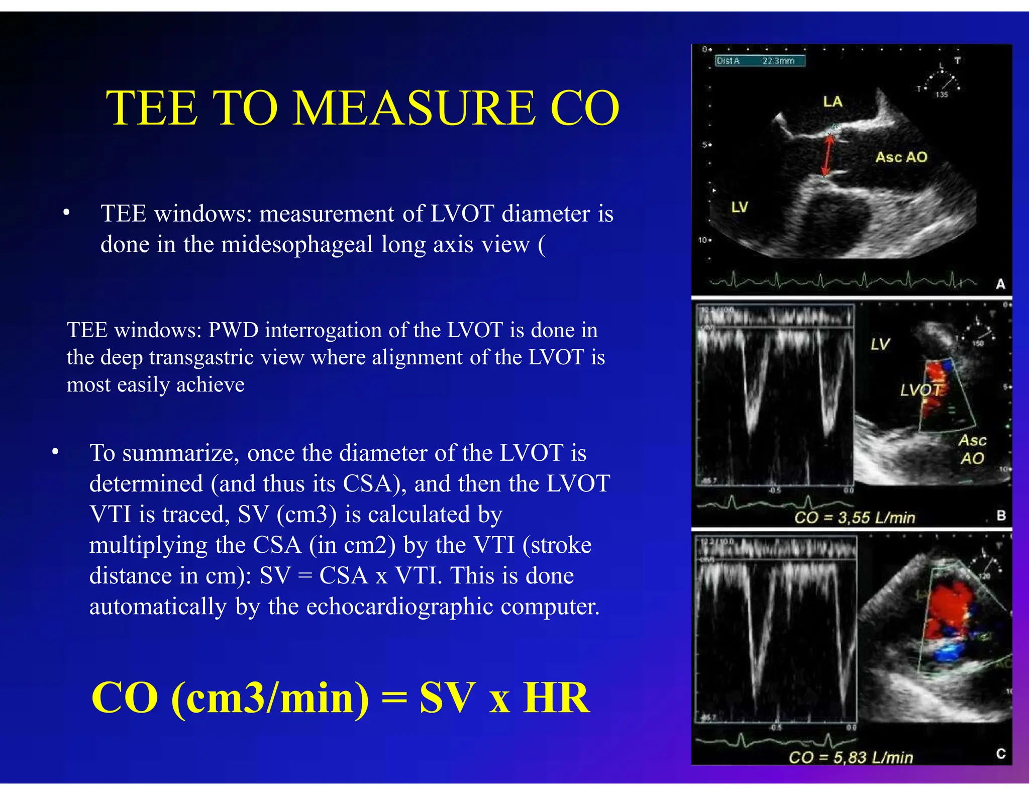 Cardiac Output Cardiac Output Monitoring Pptx