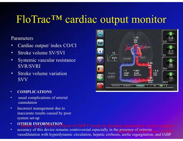 Cardiac Output Cardiac Output Monitoring Pptx