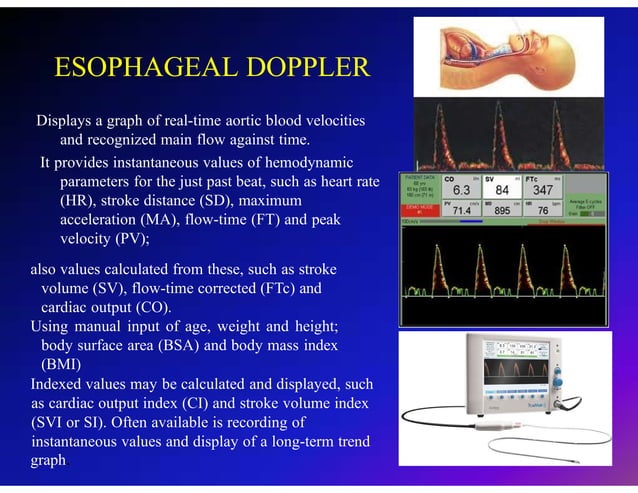 Cardiac Output Cardiac Output Monitoring Pptx