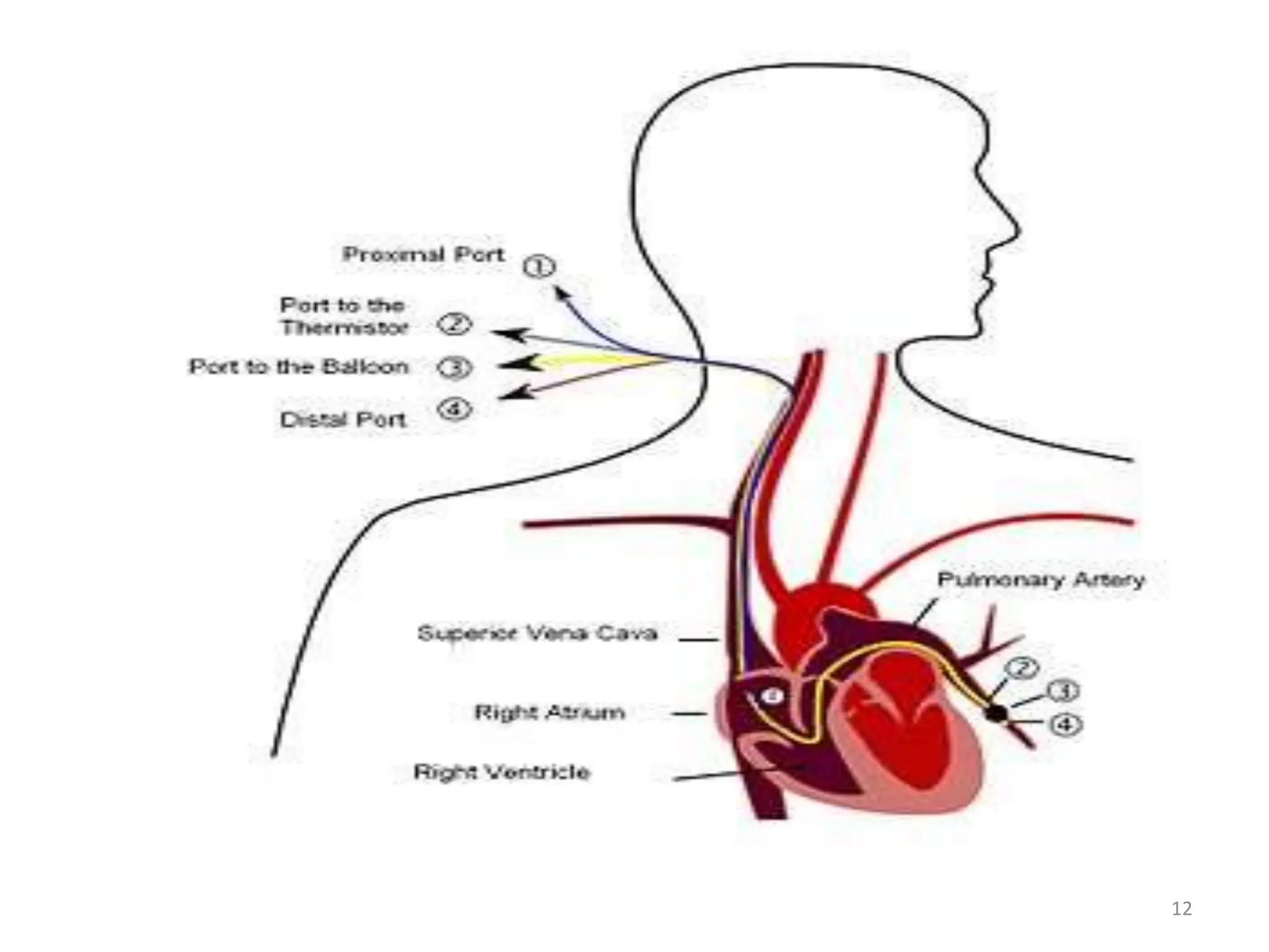 Cardiac Output Monitoring 3 Pptx Pptx