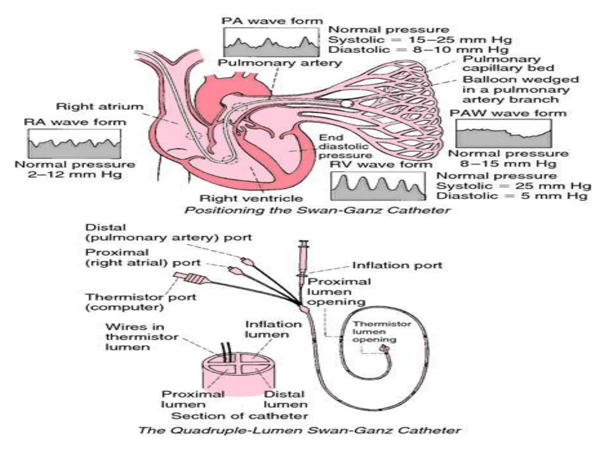 Cardiac Output Monitoring 3 Pptx Pptx First Aid Injuries