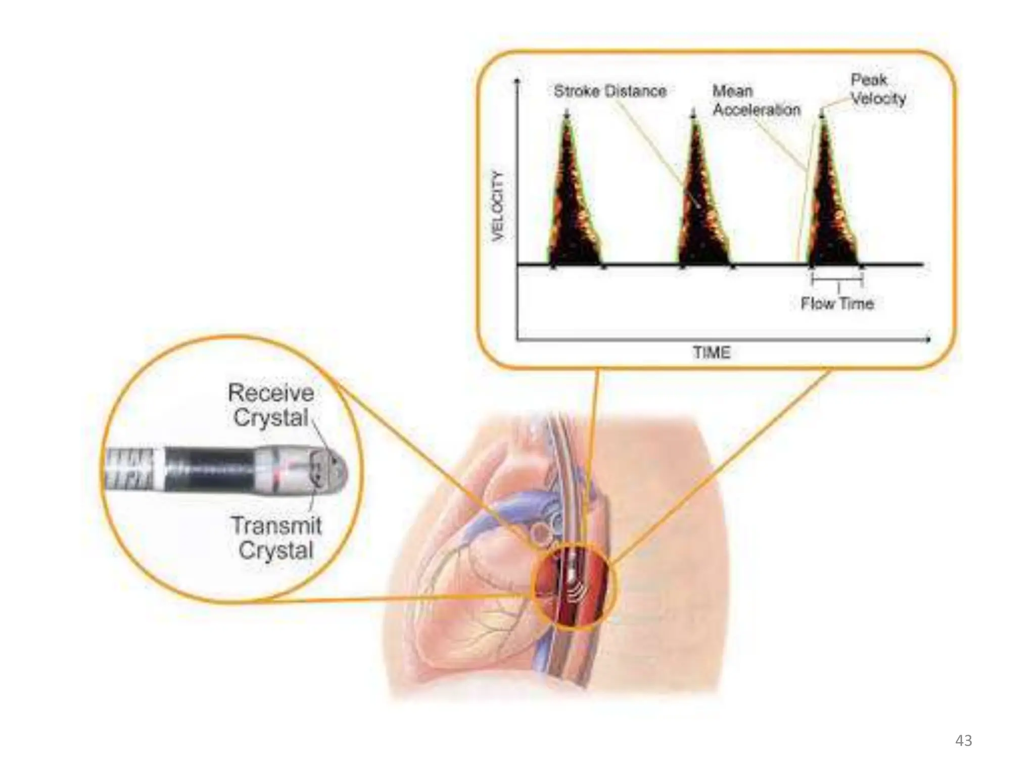 Cardiac Output Monitoring 3 Pptx Pptx First Aid Injuries