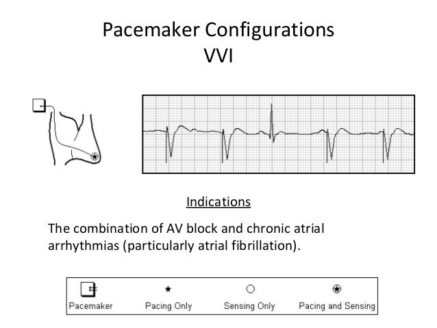 Cardiac pace makerspart 1