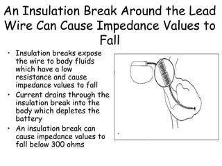 Cardiac pacemakers part ii | PPT