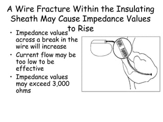 Cardiac pacemakers part ii | PPT