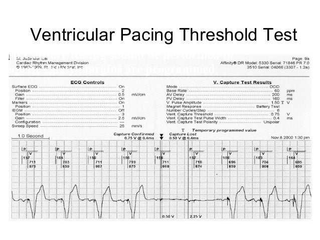 Cardiac pacemakers part ii