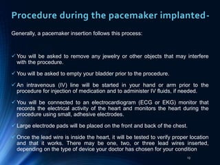 Cardiac pacemaker | PPTX