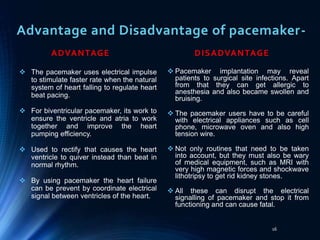Cardiac pacemaker | PPTX