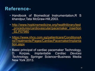Cardiac pacemaker | PPTX