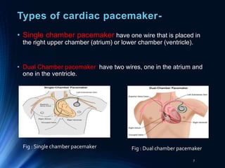 Cardiac pacemaker | PPTX