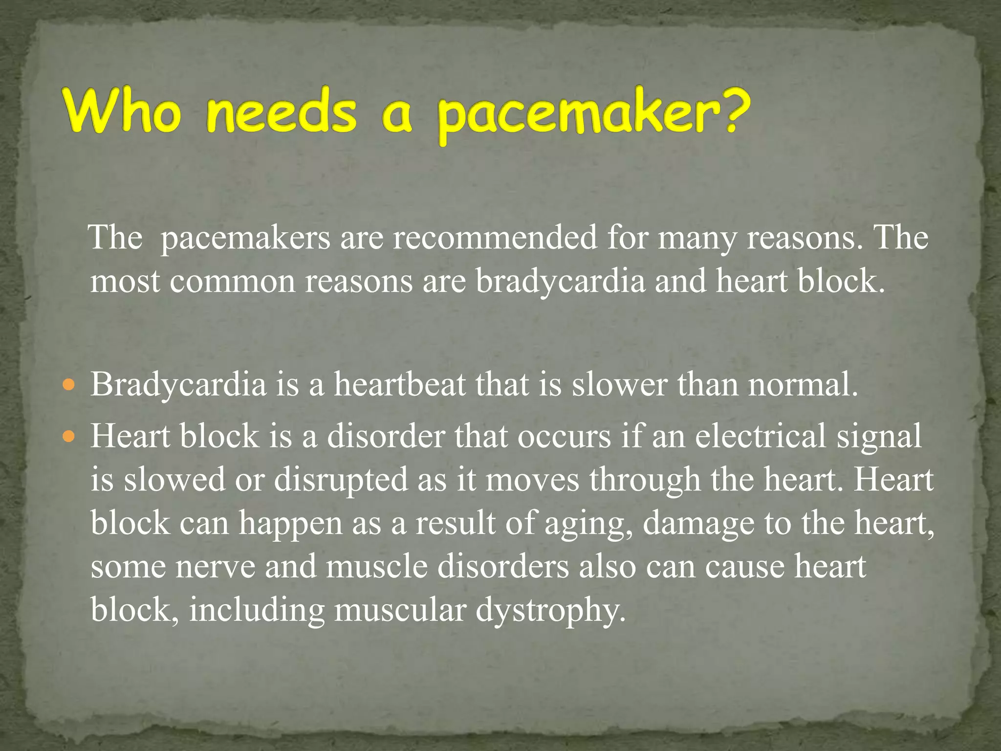 Cardiac pacemaker | PPTX