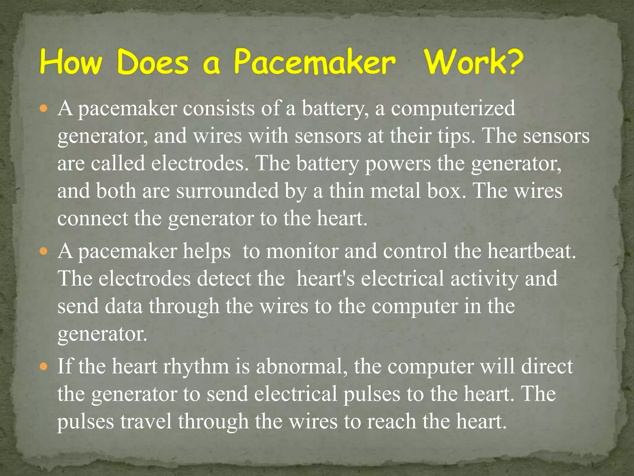 Cardiac pacemaker | PPTX