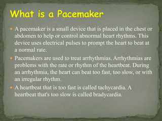 Cardiac pacemaker | PPTX