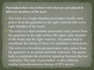 Cardiac pacemaker | PPTX
