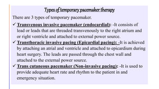 Artificial Cardiac pacemaker |medical device that generates electrical ...