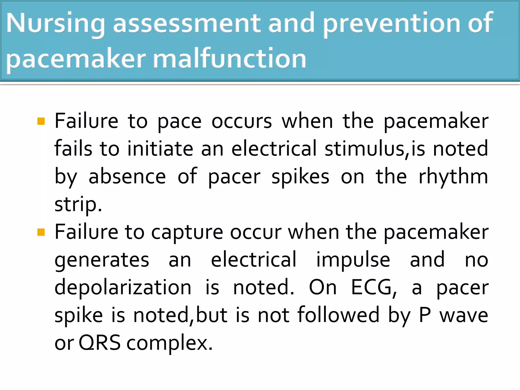 Cardiac pacemaker | PDF