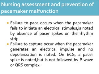 Cardiac pacemaker | PDF