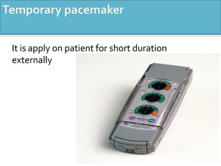 Cardiac pacemaker | PDF